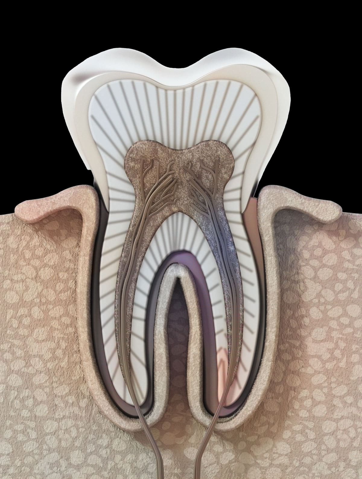 Endodontics - Root Canal Treatment - Dentince Dental Clinic | Istanbul ...